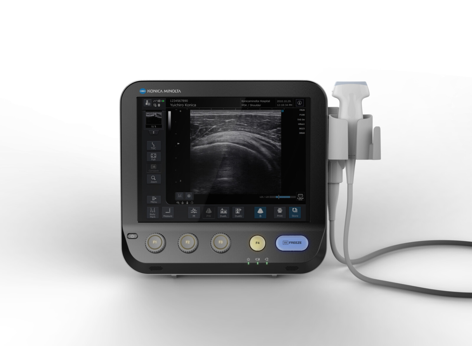 MSK Ultrasound - Advanced Diagnostic Imaging - JayXray